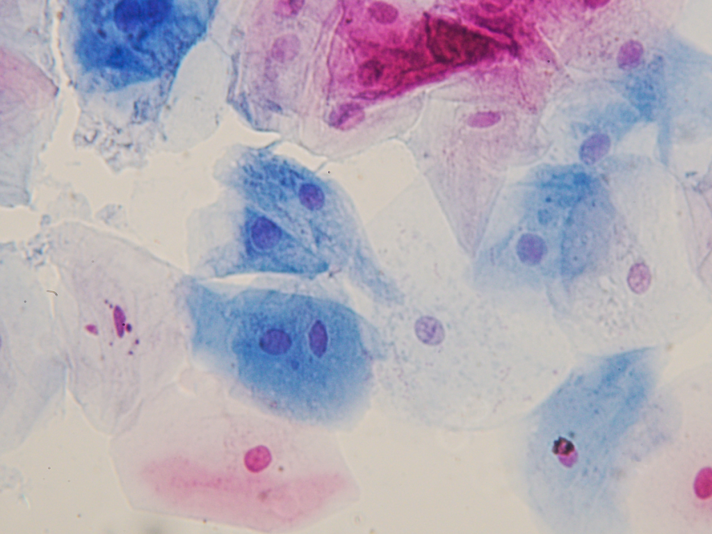 PAPA test: 10 zabluda koje morate znati | Mamaonica